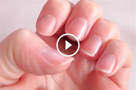 تفسير الأظافر في المنام قص تركيب خلع اظافر في الحلم ايجي بلوج نيوز