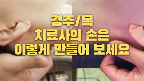 물리치료 목 치료할때 치료사의 손은 이렇게 만들어 보세요~ Youtube