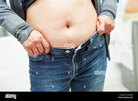 Asian Woman Show Fat Belly Big Size Overweight And Obesity At Office