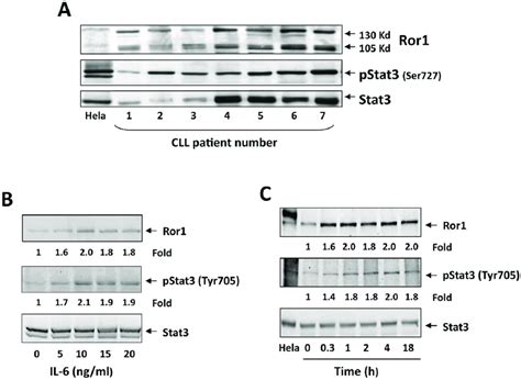 CLL Cells Constitutively Express Phosphoserine Stat3 And Ror1 Protein