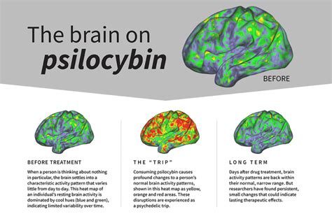 Psilocybin Generates Psychedelic Experience By Disrupting Brain Network Psychiatry