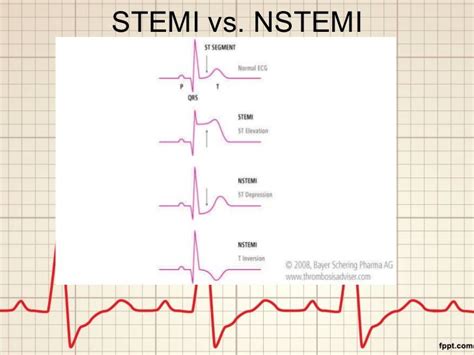 Pin On Cardiac