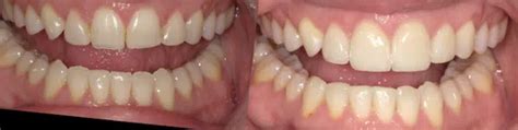 Dentist Austin Austin Tx Dentist Arbor Oaks Dental