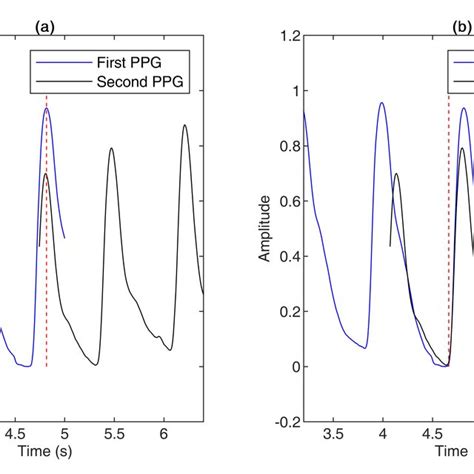 Comparison Of Stitching Two Ppg Signals Together Based On The Systolic