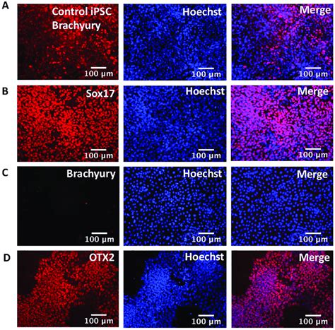 Expression Of Endoderm Mesoderm And Ectoderm Markers In Immunoassayed