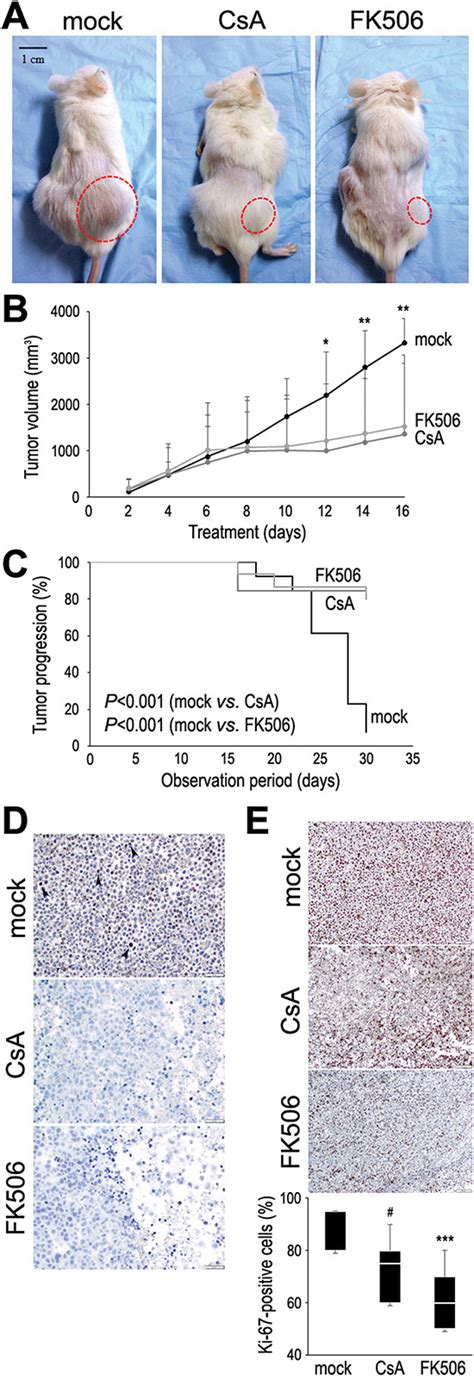 Cyclosporine A And Tacrolimus Inhibit Bladder Cancer Growth Through