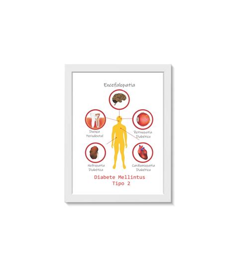 Quadro Decorativo Diabetes Endocrinologia Medicina Elo7