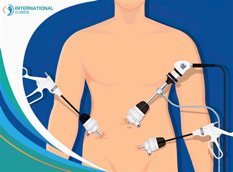 Laparoscopic Gastric Bypass Scars