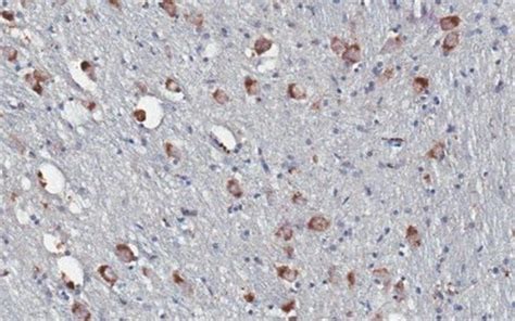 Dynorphin Sigma Aldrich