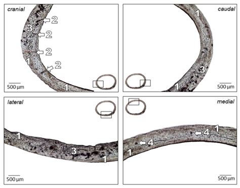 Microstructure Of Compact Bone Tissue Of Control Mouse 1 Non Vascular