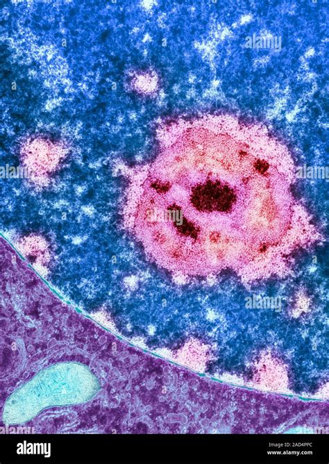 Coloured Transmission Electron Micrograph Tem Of A Section Through A Nucleus Blue And