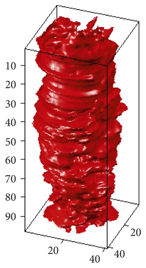3d Tumor Segmentation Results Of Case 2 Obtained With Different