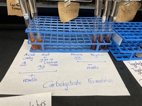 Lab Flashcards Quizlet