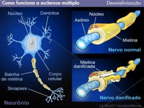Doenças Do Sistema Nervoso