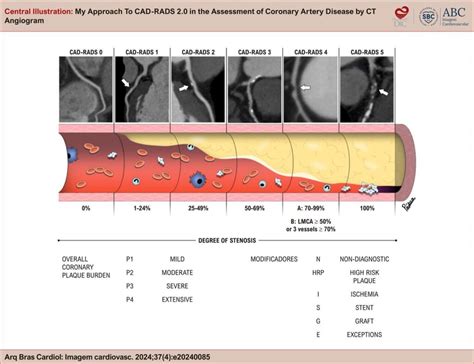 My Approach To Cad Rads 20 In The Assessment Of Coronary Artery