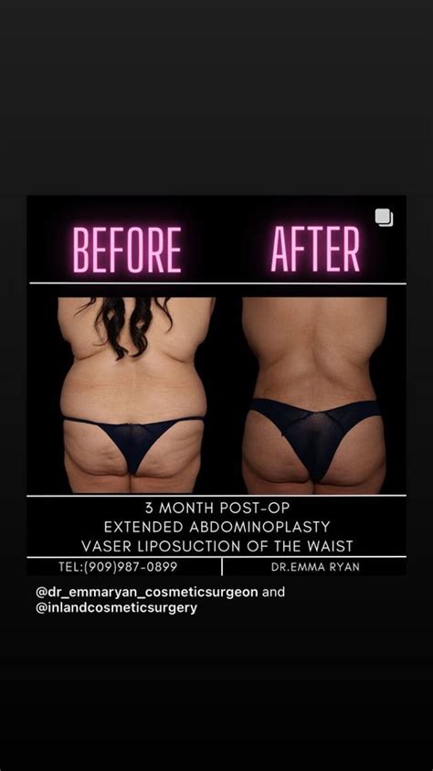 Inland Cosmetic Surgery Updated March 2025 80 Photos And 177 Reviews