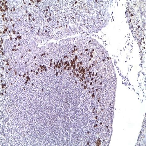 Immunoglobulin Lambda Light Chains Cish Kit Zytovision Technology
