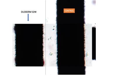 Superimposed Grid Lines Images Showing Same Magnification Control Vs