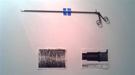 Example Laparascope 3gp Youtube