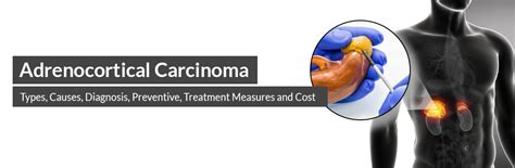 Adrenocortical Carcinoma Types Causes Diagnosis Preventive Treatment Measures And Cost Adrenocortical Carcinoma Types Causes Diagnosis Preventive Treatment Measures And Cost