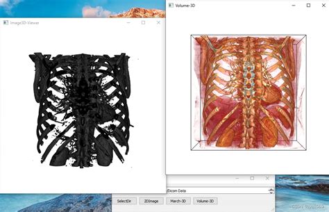 Itk Vtk 重建最简三维dicom 医学影像 仅供测试学习 Csdn博客