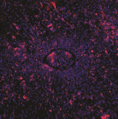 Gene Editing Precisely Repairs Immune Cells Lifeboat News The Blog