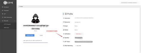 Dnslog漏洞探测二之常用dnslog平台 Csdn博客