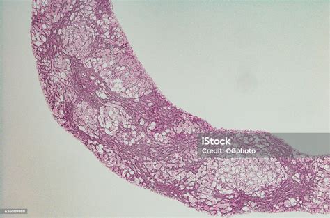 간 간 경 변 증 간 염 및 만성 간염 C 형 간염에 대한 스톡 사진 및 기타 이미지 C 형 간염 Rna 바이러스 간 내부 기관 Istock