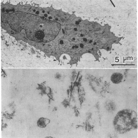 Fluorogram Of Pepsin Resistant 35s Methionine Labeled Proteins