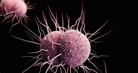 A New Drug May Boost Dwindling Treatment Options For Gonorrhea