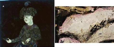 A Upper Half Of The Youth In Uv Light B Micrograph Of The Forehead