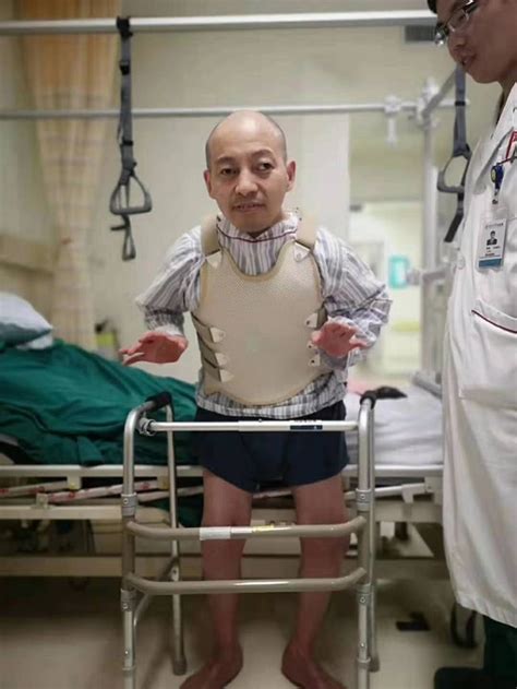 Living As A Folded Man For Nearly 30 Years Li Hua Finally Became An