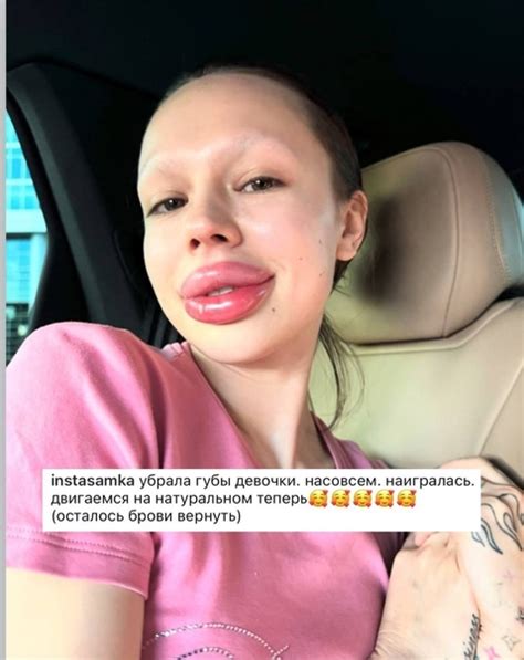 ⚡️ Даша известная как Инстасамка решила быть естественной Она отказалась от процедуры по