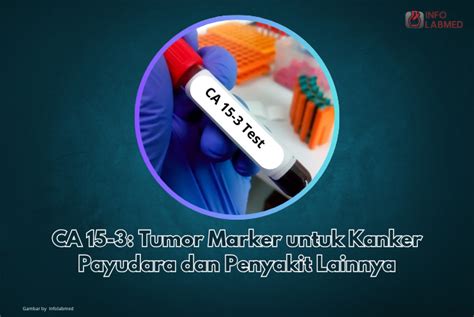 Ca 15 3 Tumor Marker Untuk Kanker Payudara Dan Penyakit Lainnya