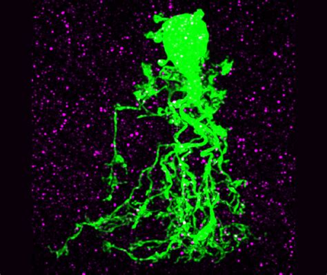 Extrasynaptic Glutamate Receptors In The Retina The Department Of