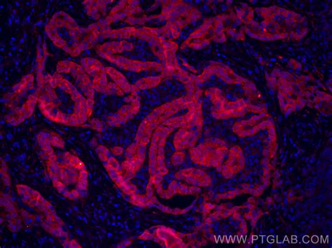 Galectin 3 Antibody Cl594 60207 Proteintech 武汉三鹰生物技术有限公司
