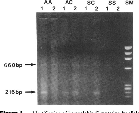 Figure I From Rapid Detection Of The Hemoglobin C Mutation By Allele