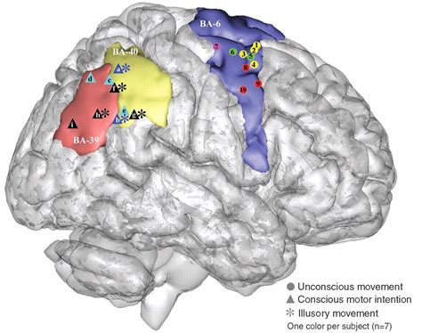 Posterior Parietal Cortex Right Hemisphere