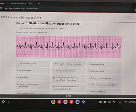 Tures AHA ELearning ACLS Prec StudyX