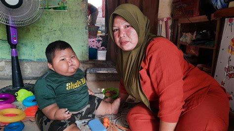 Cerita Kenzie Balita Obesitas Asal Bekasi Dapat Pelayanan JKN Mudah