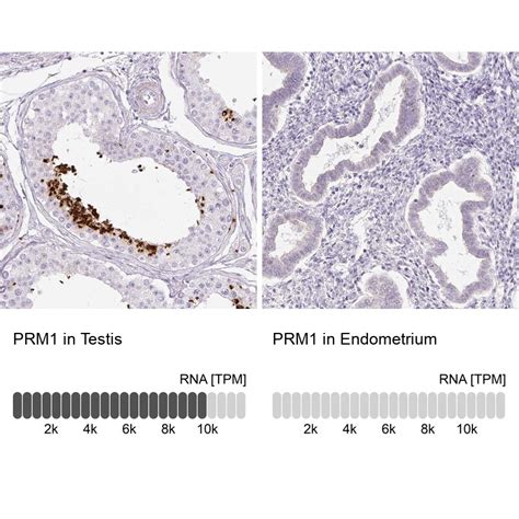 PRM1 Antibody (PA5-63074)