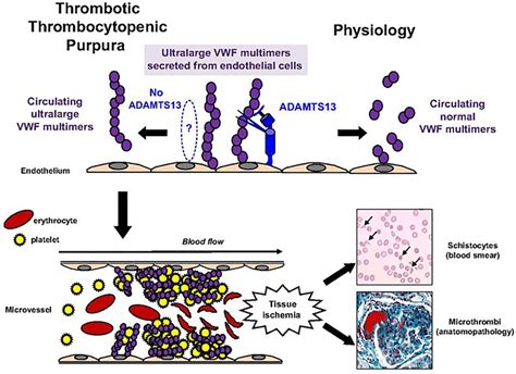 Pathophysiology Of Ttp Pathophysiology Of Ttp In Physiologic Download Scientific Diagram