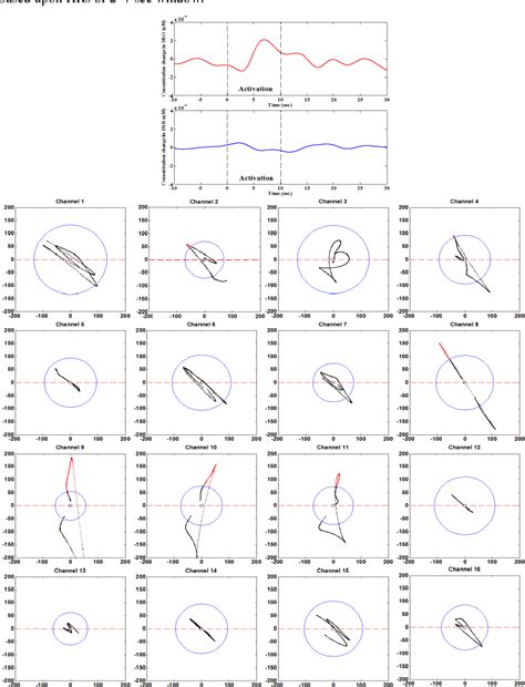 Figure 6 From Detection And Classification Of Three Class Initial Dips From Prefrontal Cortex