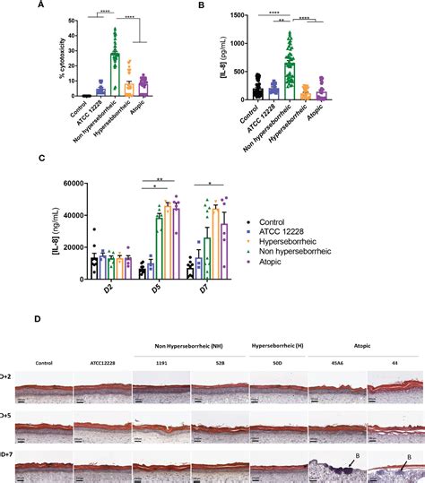 Staphylococcus Epidermidis Clones Express Staphylococcus 40 Off