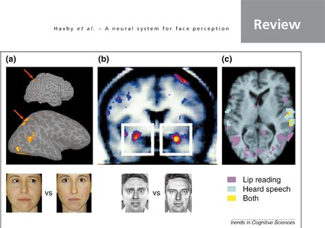 Structure Of Superior Temporal Sulcus Semantic Scholar