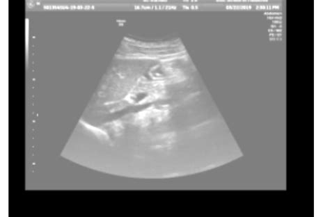 Mapper Image Interpolation · Issue 1293 · Kitwarevtk Js · Github