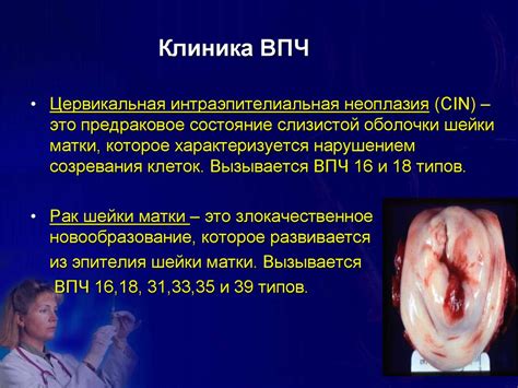 Специфические воспалительные заболевания женских половых органов