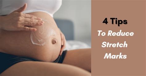 4 Tips To Reduce Stretch Marks Momzjoycom