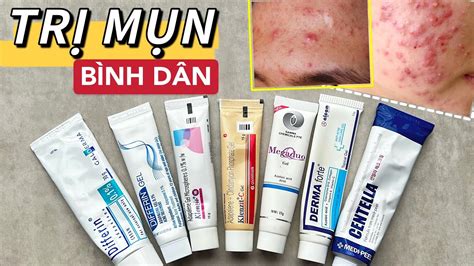 Trị Mụn Hiệu Quả Bí Quyết Và Phương Pháp An Toàn Cho Làn Da Khỏe Mạnh