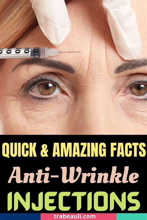 Quick Facts About Anti Wrinkle Injections The Benefits Trabeauli Artofit